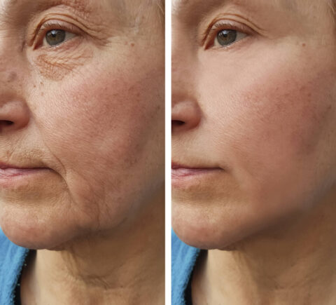 Why Weight Loss Can Age Your Face — And How to Fix It - Flow Wellness